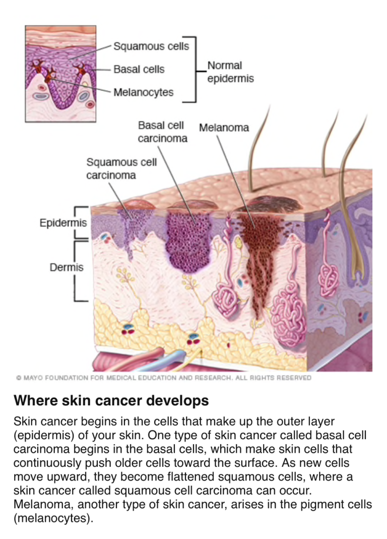 Israel and Stuff » cancerIsrael and Stuff