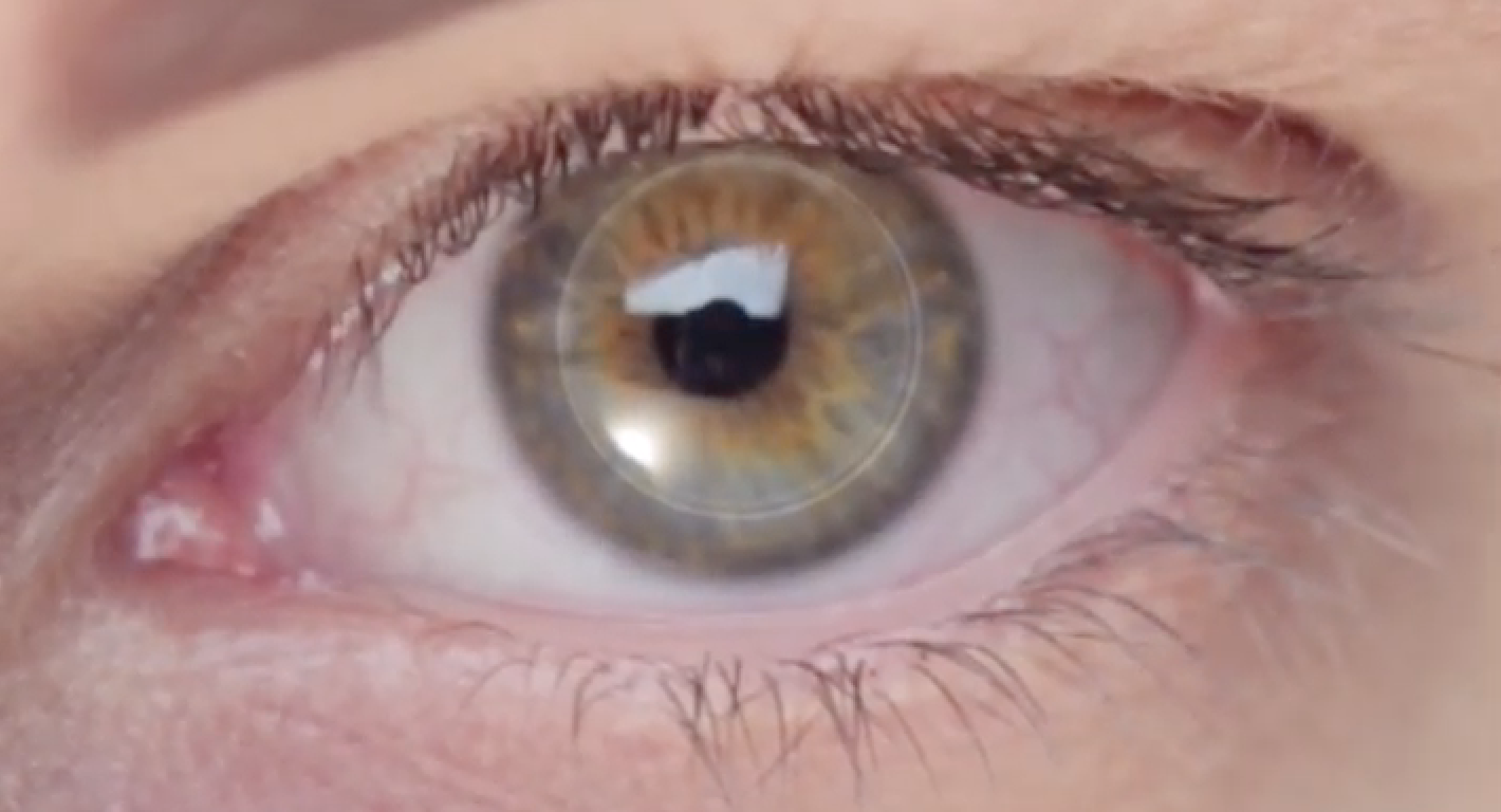 Israel and Stuff » Israeli synthetic cornea could restore eyesight to ...
