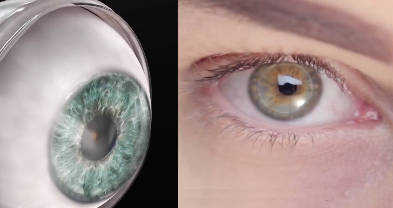 Israel and Stuff » Israeli invented synthetic cornea returns eyesight ...